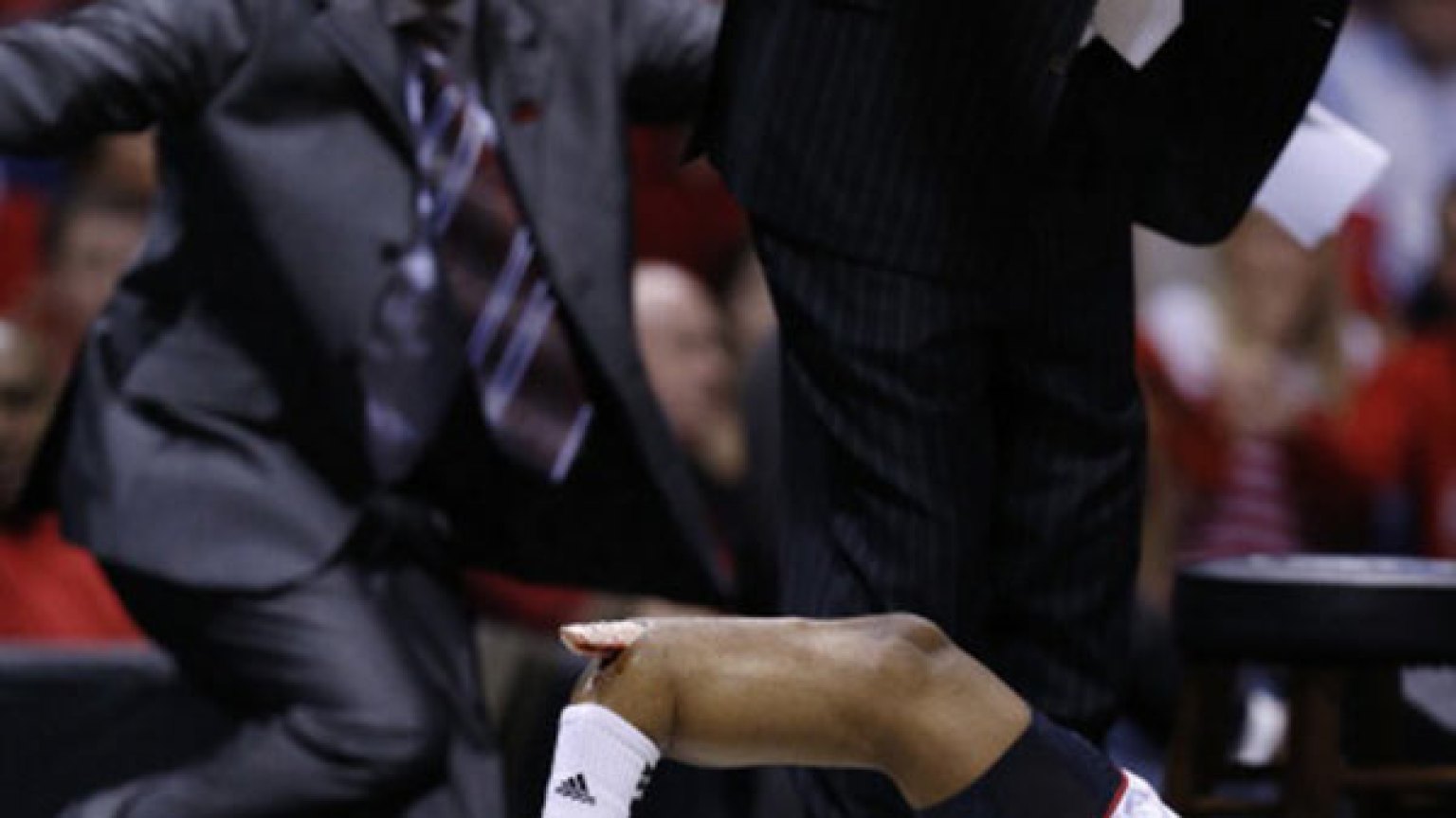 [PIC] Kevin Ware Bone — See The Louisville Player’s Horrifying Injury ...