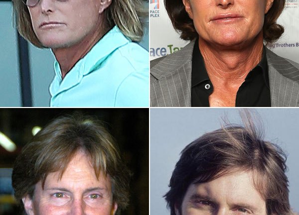 [PICS] Bruce Jenner’s Plastic Surgery — A Scary Facial Transformation ...