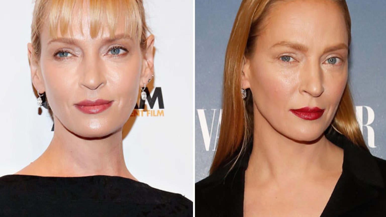 [PICS] Uma Thurman’s Face: Plastic Surgery? — See Before & After Photos ...