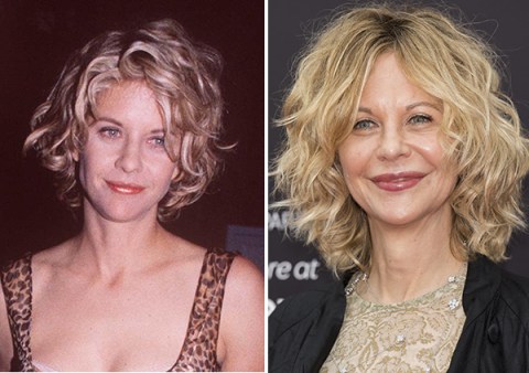 [PICS] Celebrities Before & After Plastic Surgery: Photos Of The ...
