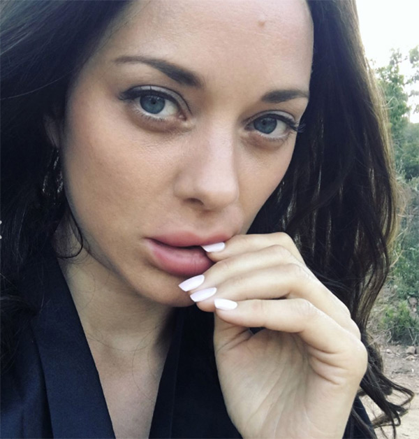 Marion Cotillard’s Plastic Surgery: Did She Get Lip Injections ...