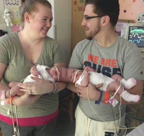 [PICS] Conjoined Twins Erin & Abby Delaney – Hollywood Life