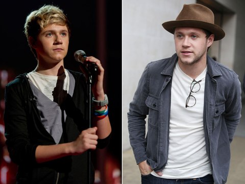 One Direction Makeovers: Photos Of Their Then & Now Looks – Hollywood Life