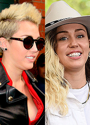 Changing Celebrity Faces: Stars Who Had Massive Transformations ...