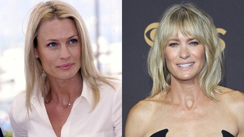 Stars Admitting Plastic Surgery — Which Celebrities Admit Going Under ...