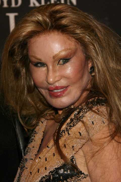 9 Celebs’ Weirdest Surgery Moments Of All-Time — Pics – Hollywood Life