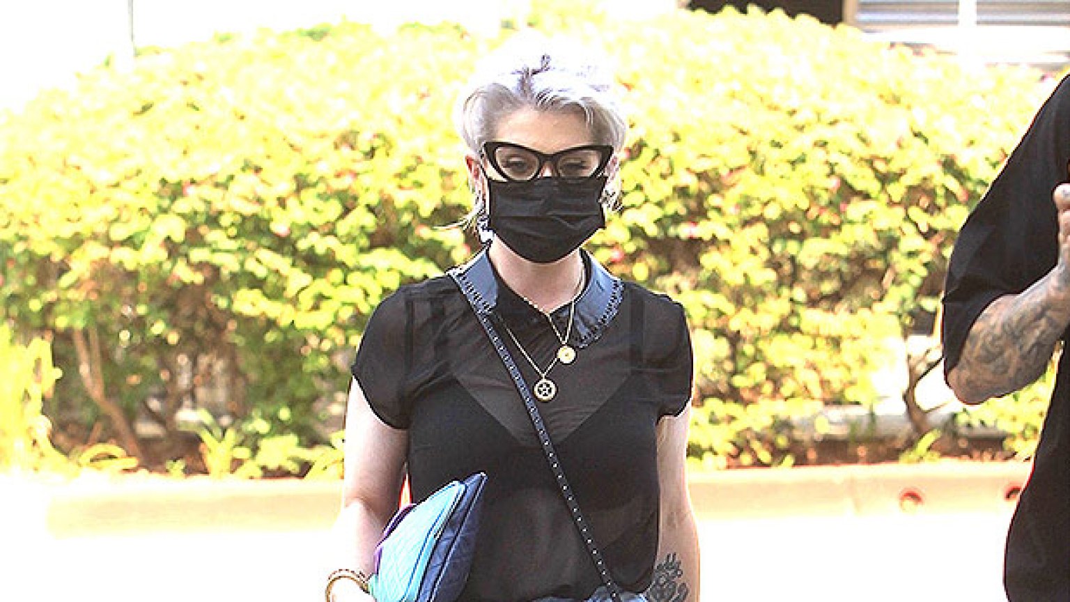 Kelly Osbourne’s Gastric Sleeve Surgery: How She Lost 85 Pounds ...